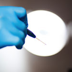 Electrocauterization Surgery